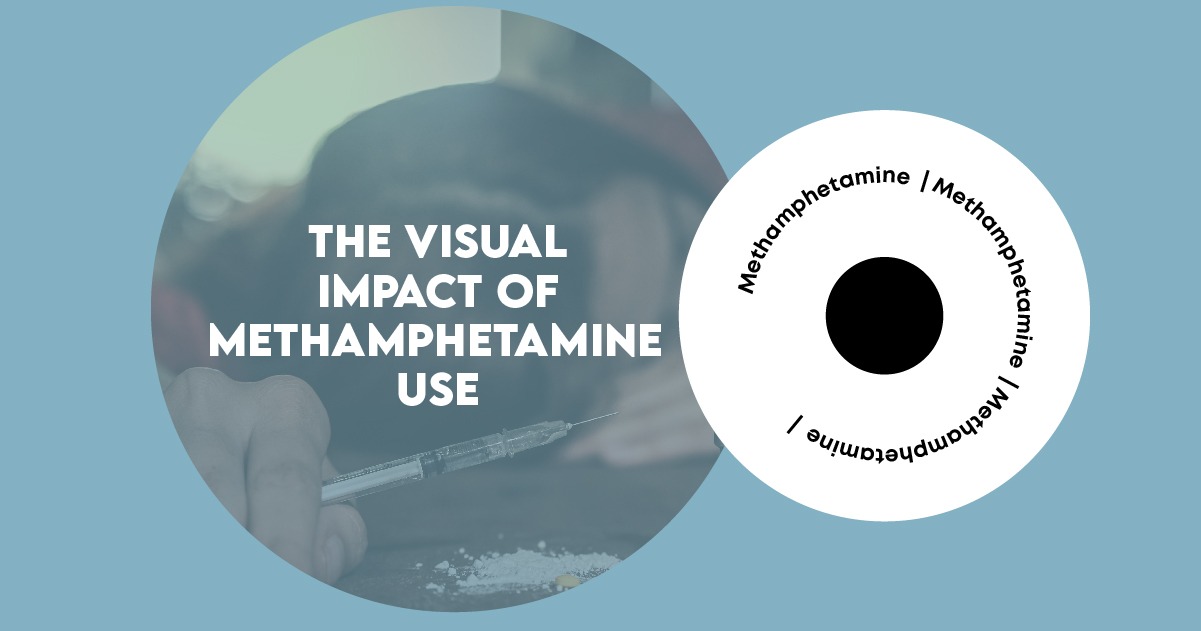 Visual Effects of Methamphetamine Use Explained in Detail